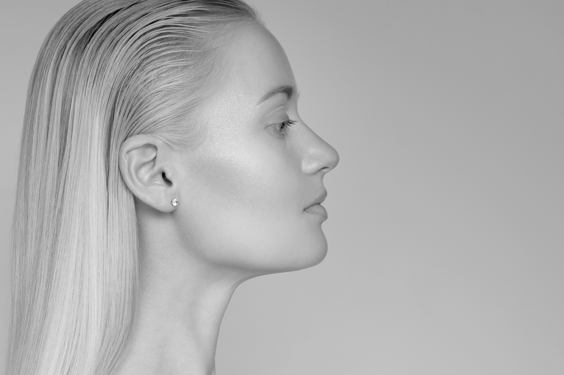 Grote neusgaten – Blooming Plastische Chirurgie